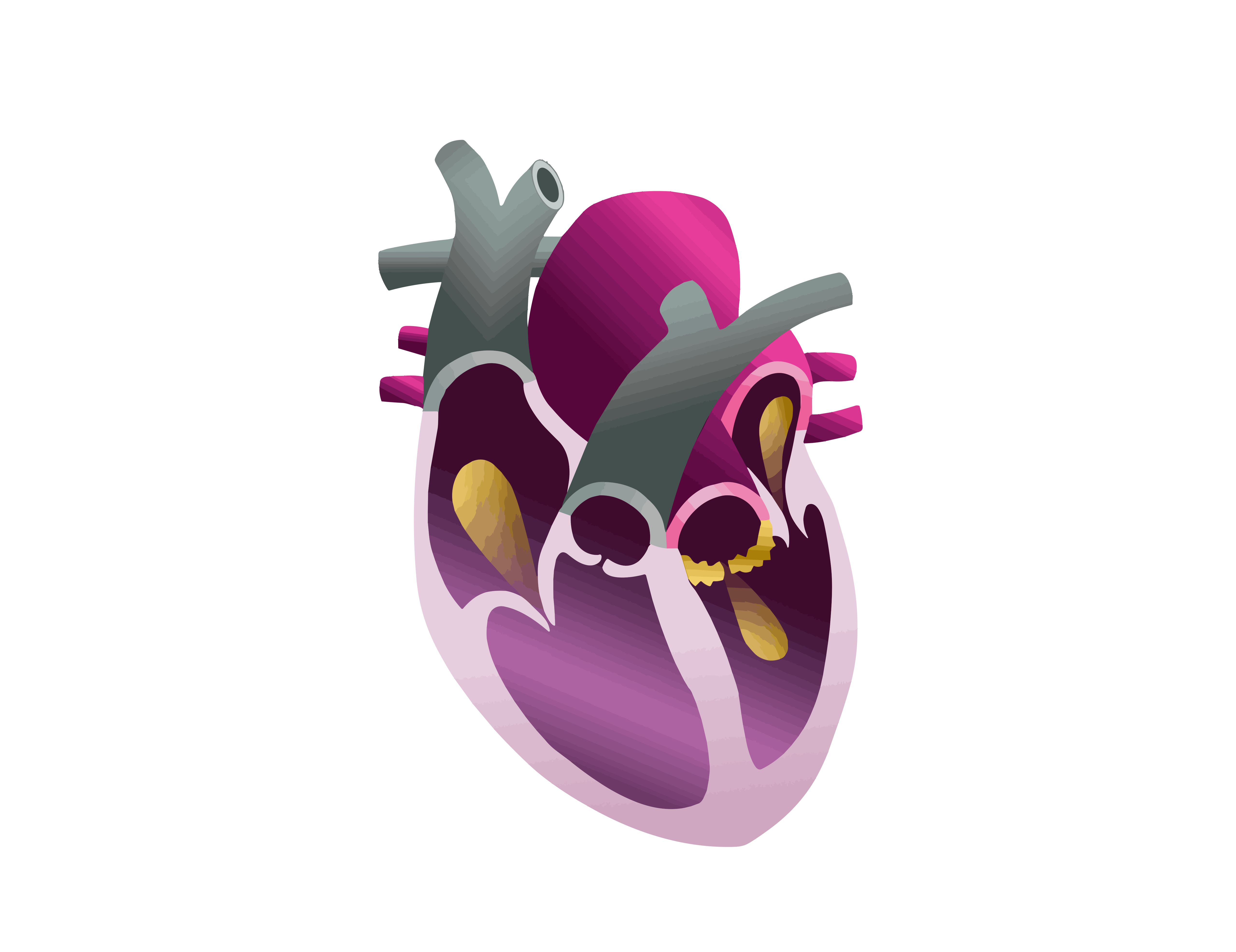 EACVI-MMVD Study